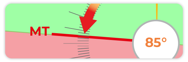 Nomenclature For Animations For Torsion Springs