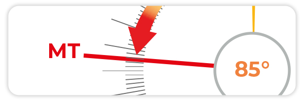 Nomenclature For Animations For Torsion Springs